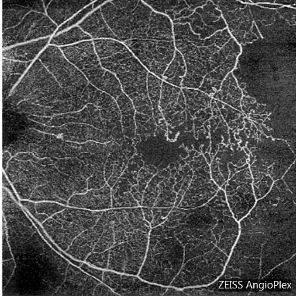 Office Procedures - Northern Illinois Retina